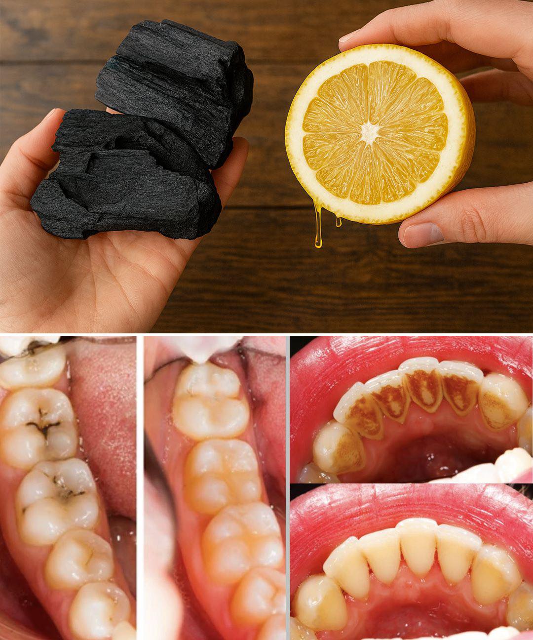 The magic of lemon juice and activated charcoal: Natural DIY solutions ...
